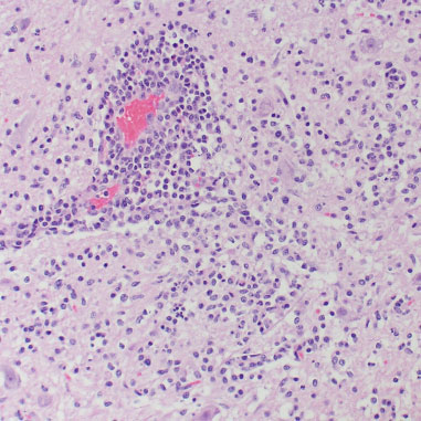 Sapelovirus – Swine Health Information Center